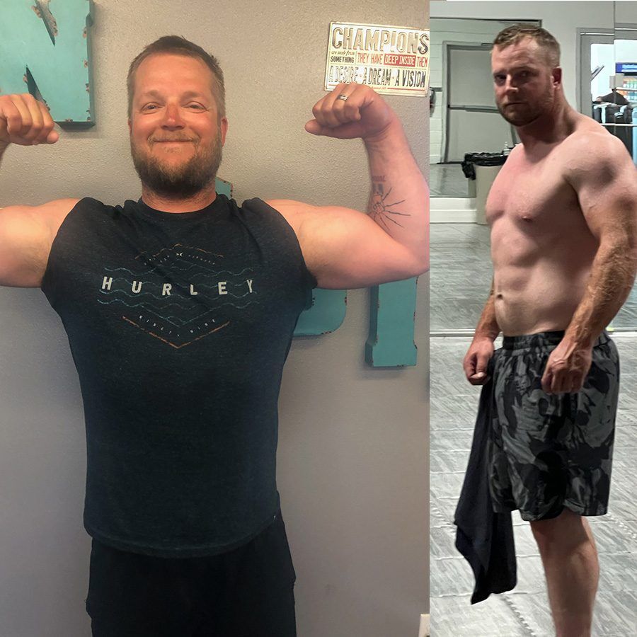 TRT dosage, average and maximum testosterone dose for injection